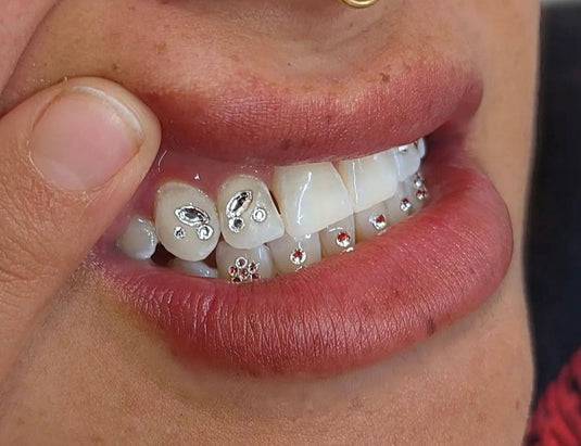 Strass dentaires – strass dentaires