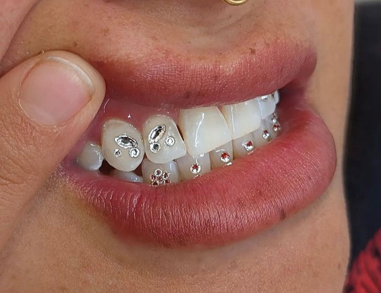 Strass dentaires – strass dentaires