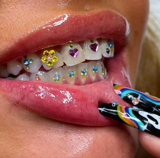 Strass dentaires – strass dentaires