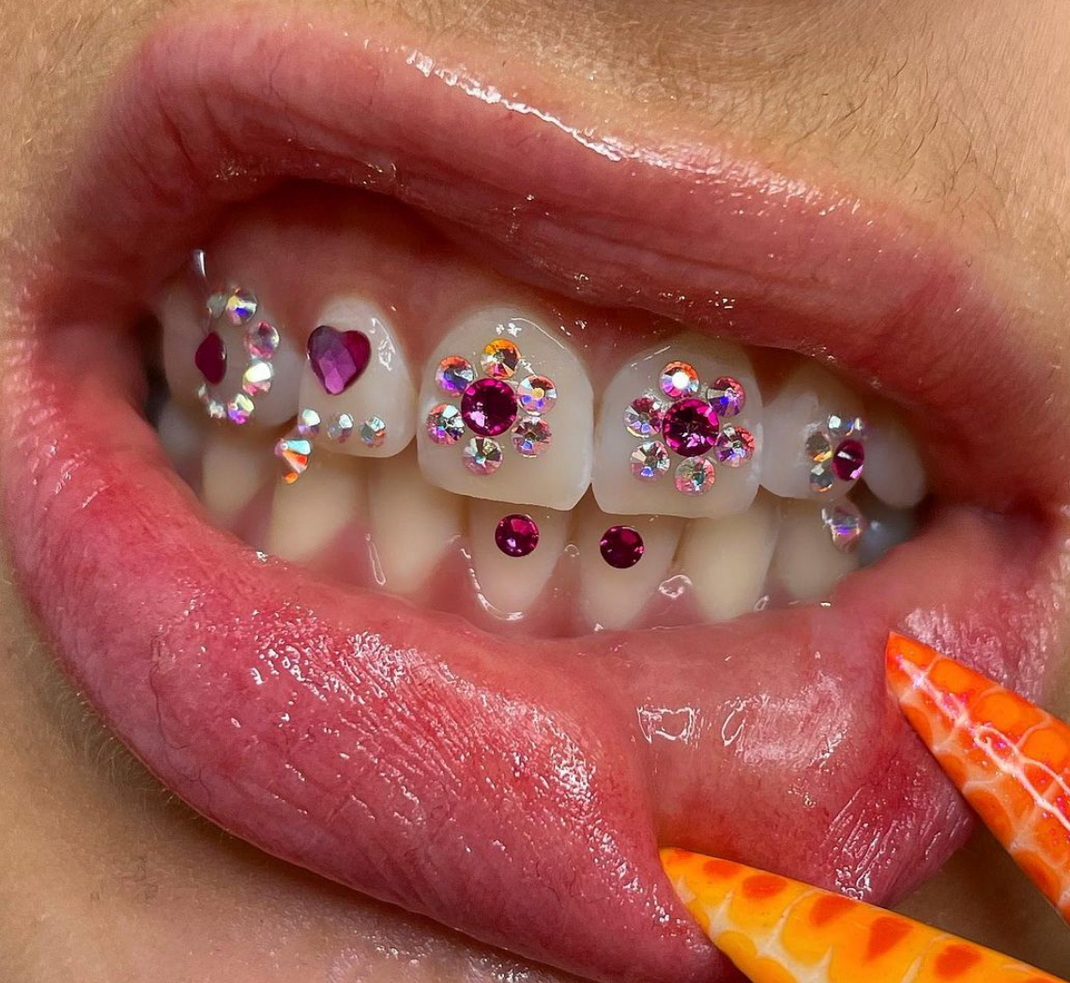 Strass dentaires – strass dentaires